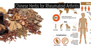 Rheumatoid Arthritis and Acupuncture - The Acupuncture Clinic